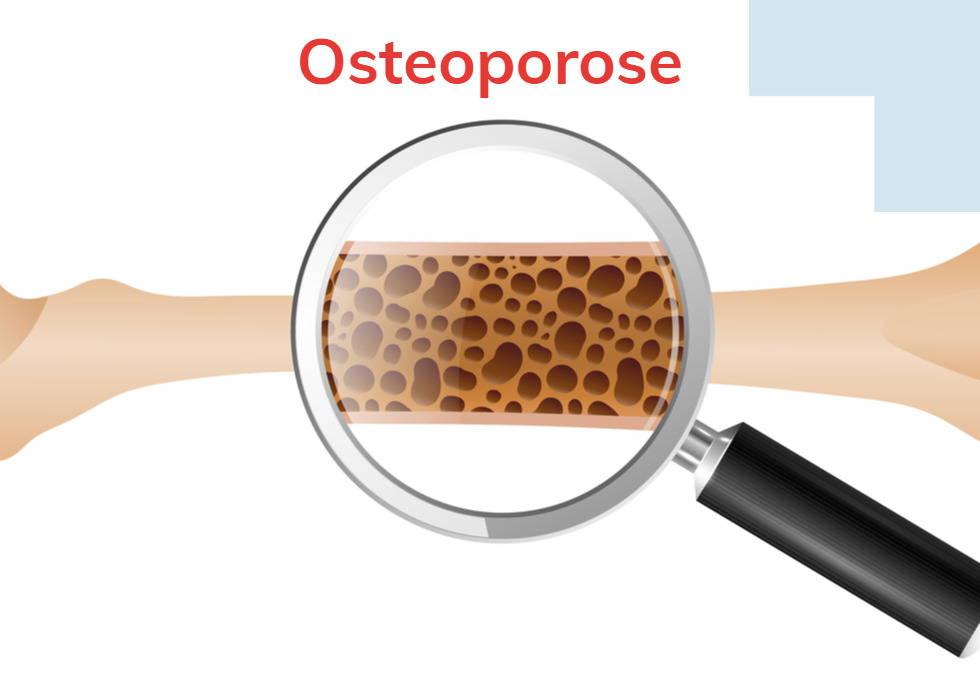 Blog - Pazzox, online apotheek zonder zorgen - Pazzox